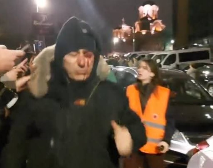 СНИМАК ПОКАЗАО ИСТИНУ: Повређеног полицајца испред РТС-а ударио припадник Жандармерије